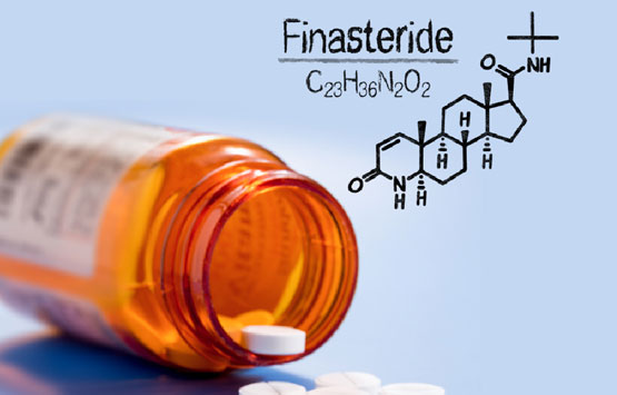 อันตรายที่คาดไม่ถึงจากการใช้ยา Finasteride - AloEx หยุดผมร่วง ลดผมบาง ...